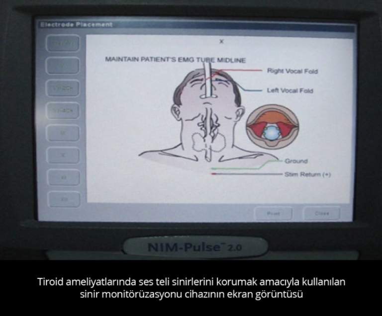 Papiller Tiroid Kanseri - Prof. Dr. Çetin Vural